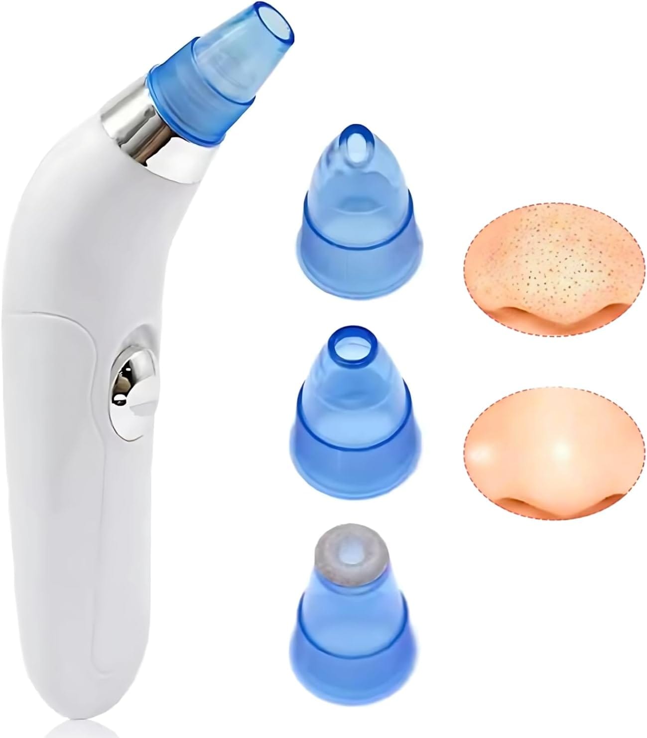 تسوق Radiotronics Vacuum Blackhead Remover, Face Suction Pore Vacuum ...